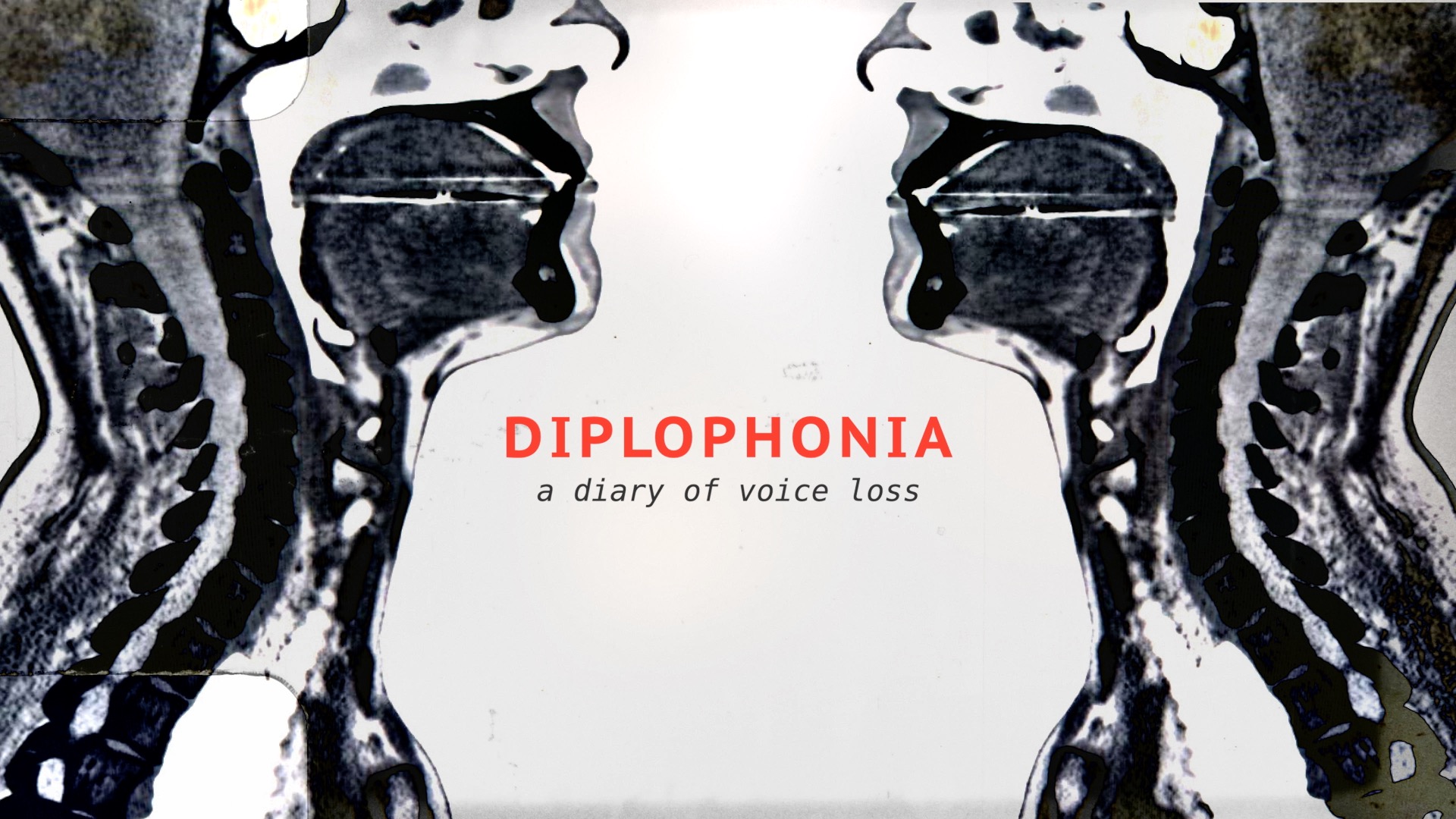 Diplophonia: A Diary of Voice Loss - Studio-Lu Stories